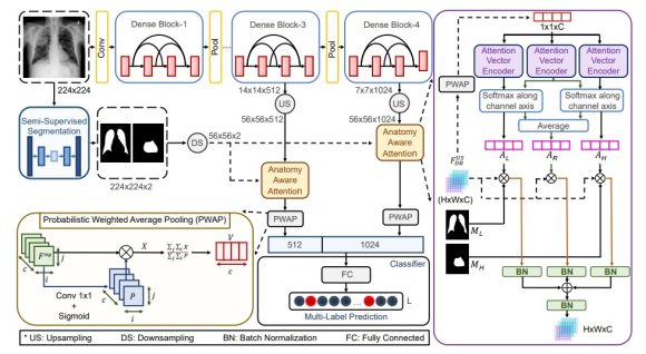 Anatomy-XNet: Thoracic Disease Classifier for Chest X-rays - Biomedical Engineering | BUET