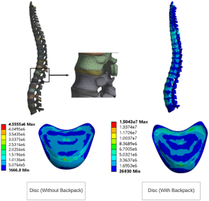 Effect of Backpack on Spine Biomechanics - Biomedical Engineering | BUET